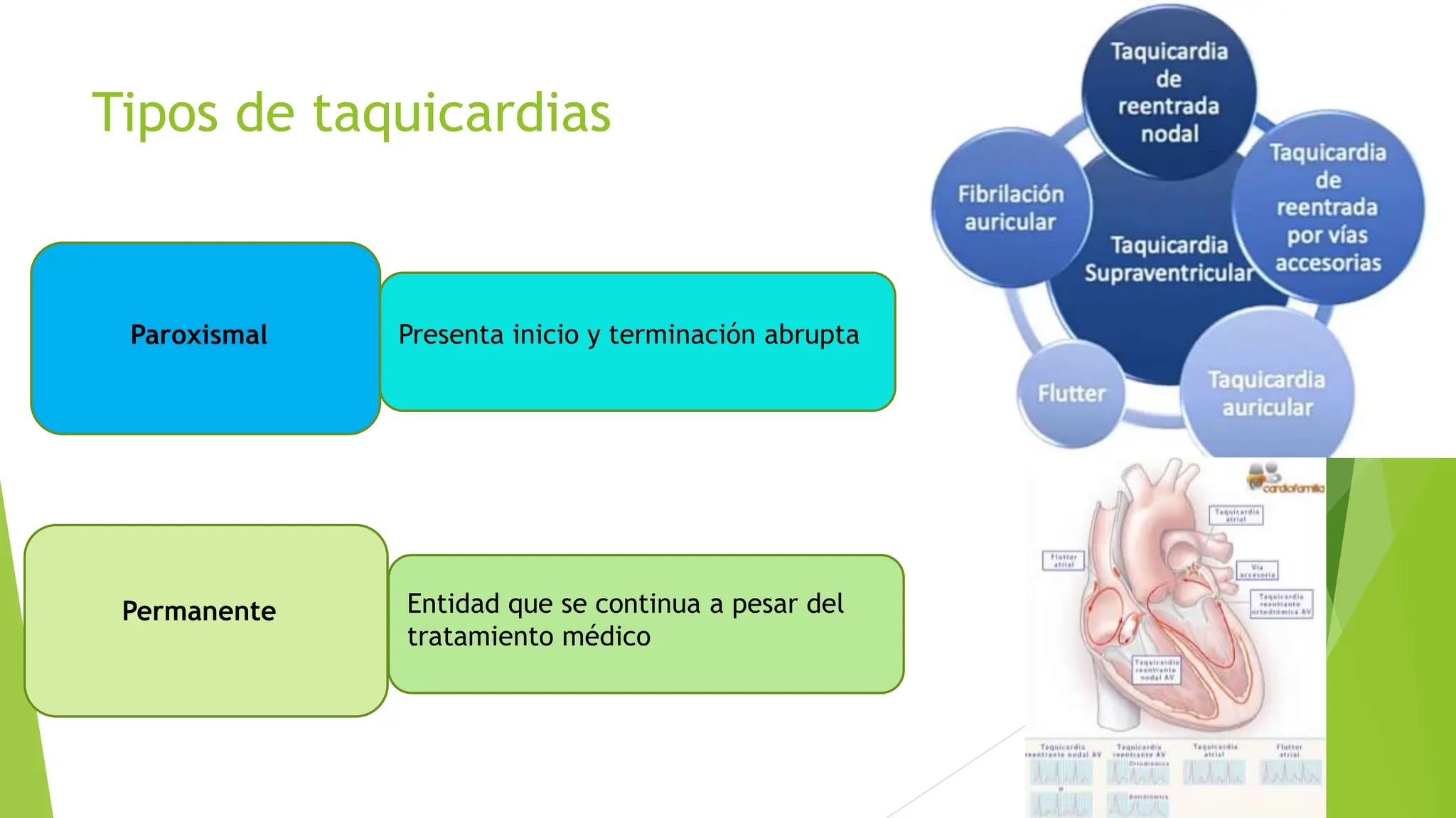 TAQUICARDIA SUPRAVENTRICULAR manejo y vigilancia | PPTX
