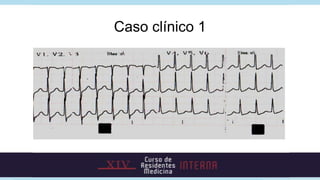 Taquicardia supraventricular | PPTX