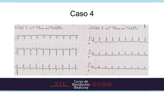 Taquicardia supraventricular | PPTX