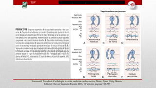 Taquicardia supraventricular Parte I | PPTX