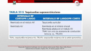 Taquicardia supraventricular Parte I | PPTX