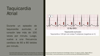 taquicardia supraventricular tipos causas | PPTX
