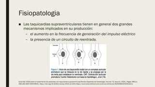 taquicardia supraventricular tipos causas | PPTX