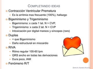 Taquicardia ventricular | PPTX