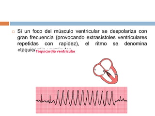 Taquicardia Ventricular Sin Pulso
