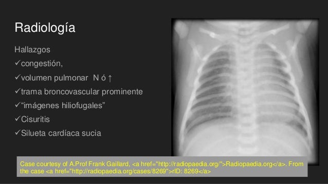 Taquipnea transitoria del recién nacido (ttrn)