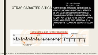 TAQUICARDIA SUPRAVENTRICULAR URGENCIAS MEDICO QUIRUGICAS | PPTX