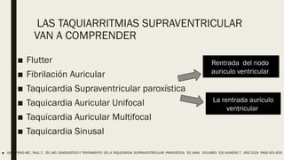 TAQUICARDIA SUPRAVENTRICULAR URGENCIAS MEDICO QUIRUGICAS | PPTX