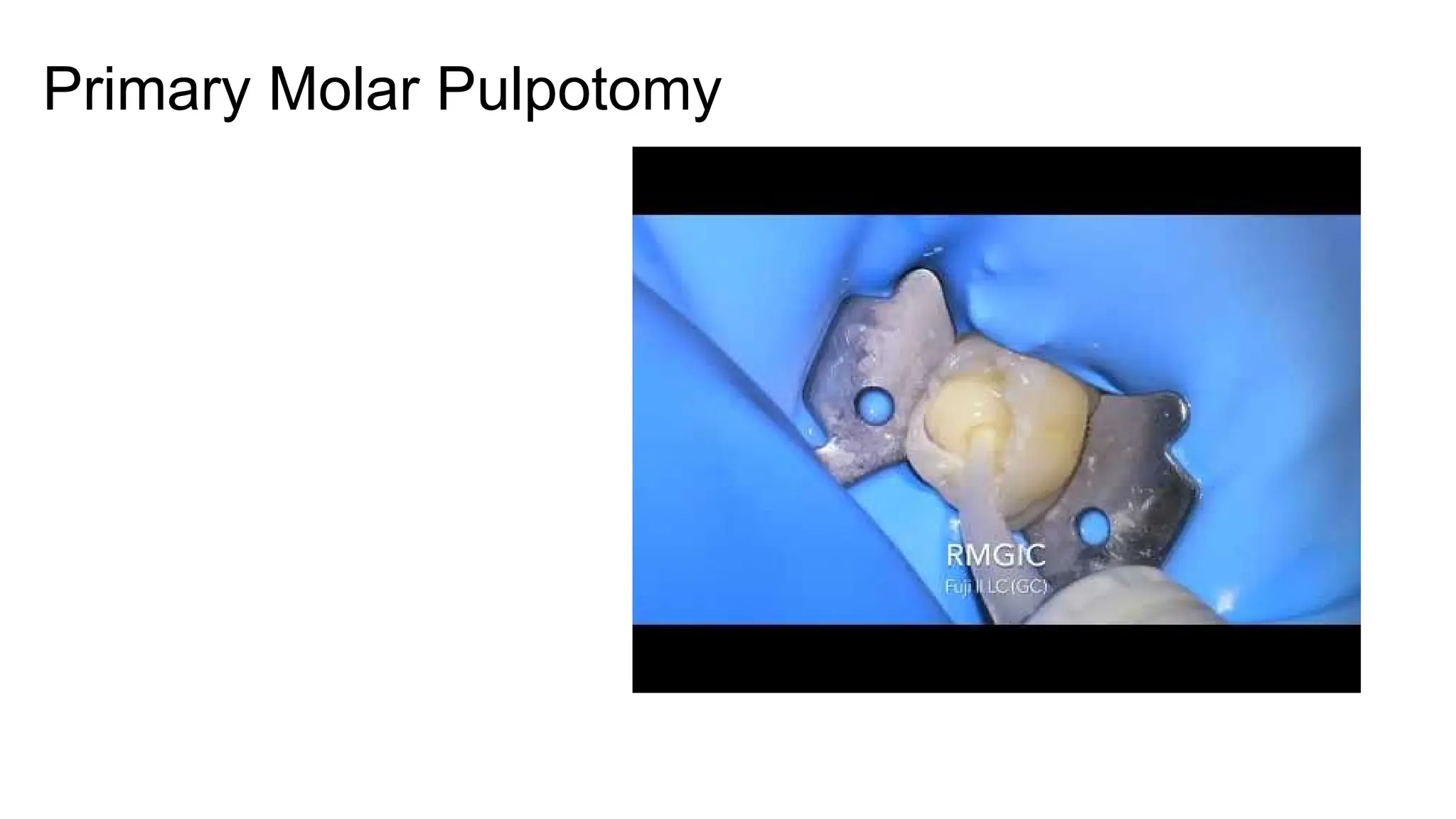Endodontics Slides for Dental Assistants | PPTX