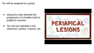 Endodontics Slides for Dental Assistants | PPTX