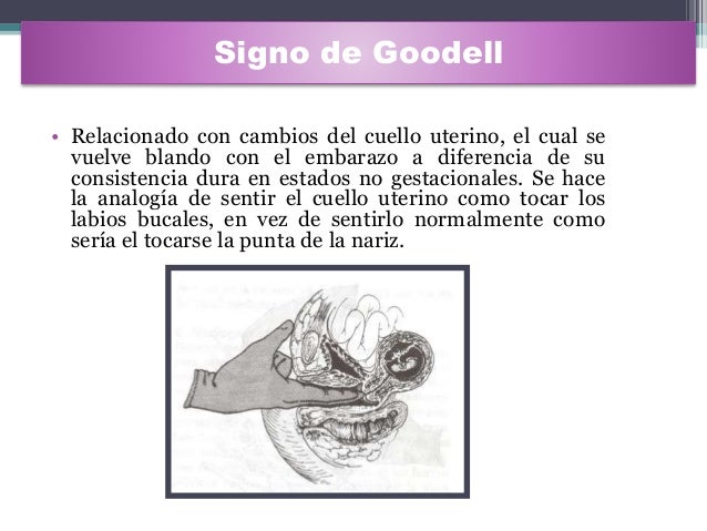 Tarea 2 jimr diagnostico de embarazo