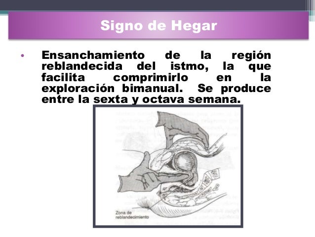Tarea 2 jimr diagnostico de embarazo