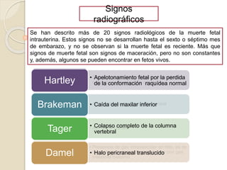 Tarea37 jimr muerte fetal intrauterina | PPTX