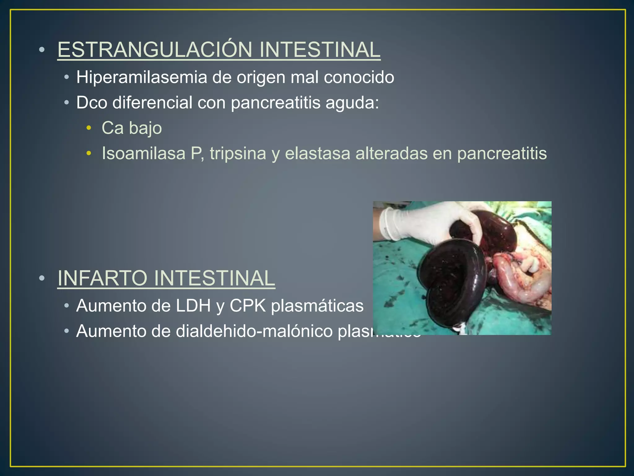Obstruccion intestinal | PPT