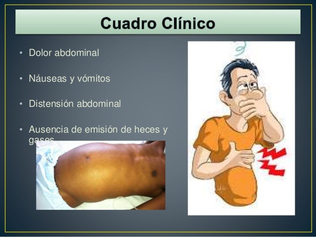 Obstruccion intestinal