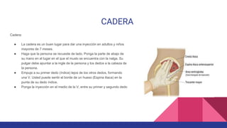 Aplicacion De Inyeccion Im Intradermica Y Subcutanea Pptx