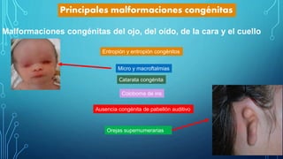Tarea9. anomalias y malformaciones geneticas.Eudys.Farfan. | PPT