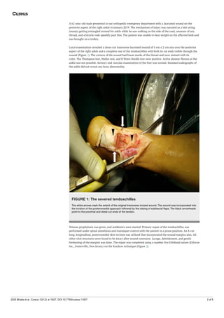 Kite String Injury Causing a Complete Tear of the Tendoachilles | PDF