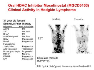 Targeted therapy for Hodgkin’s Lymphoma | PPTX