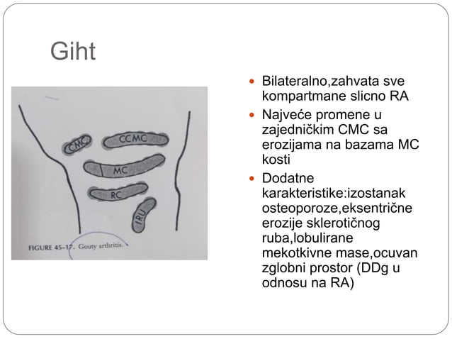 target mesta u reumi.pptx