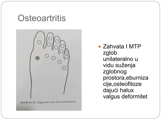 target mesta u reumi.pptx