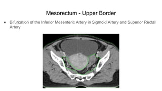 TARGET DELINEATION IN RECTUM CANCER BY DR KANHU | PPTX