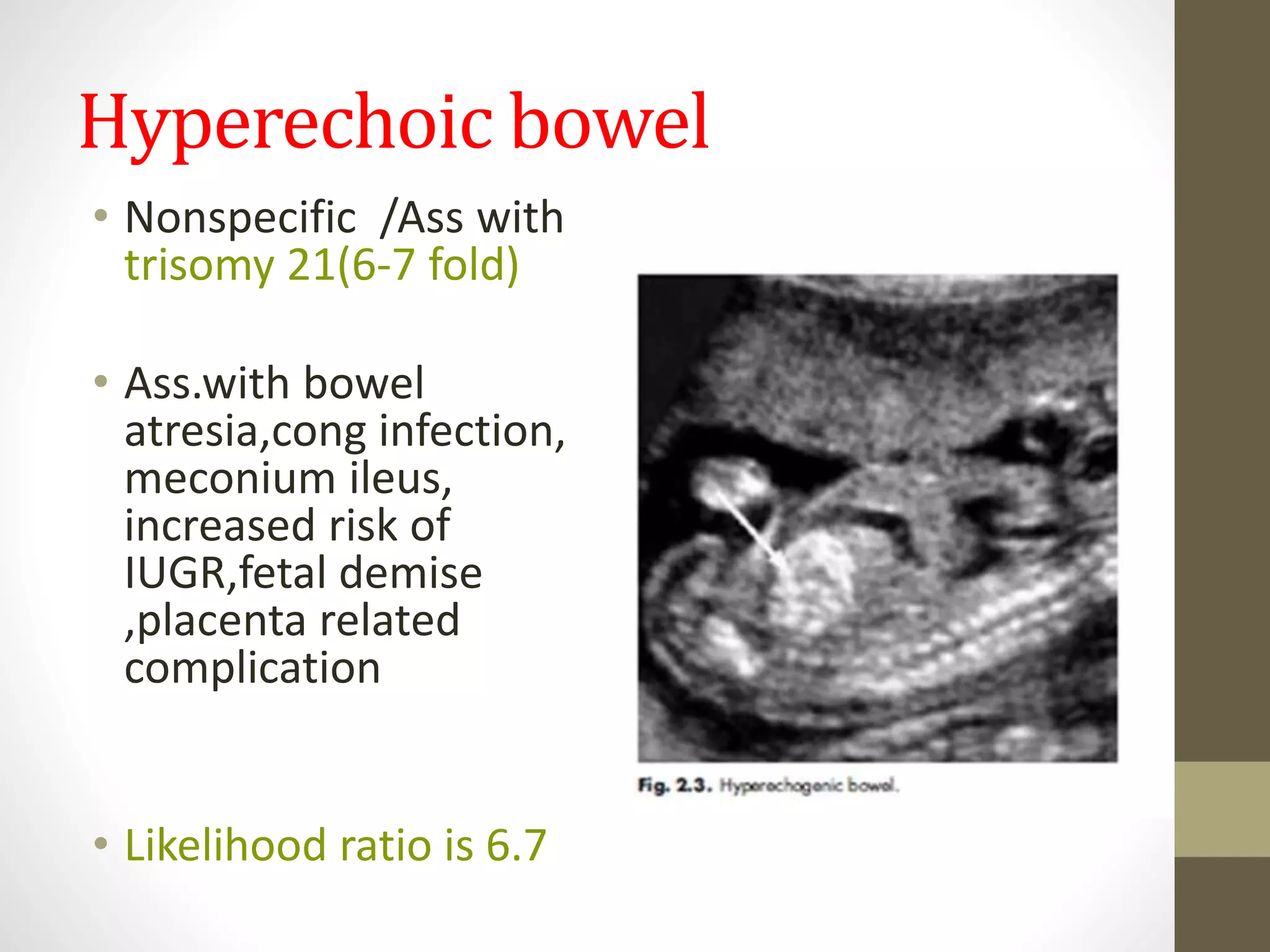 Target scan for fetal anomalies | PPTX