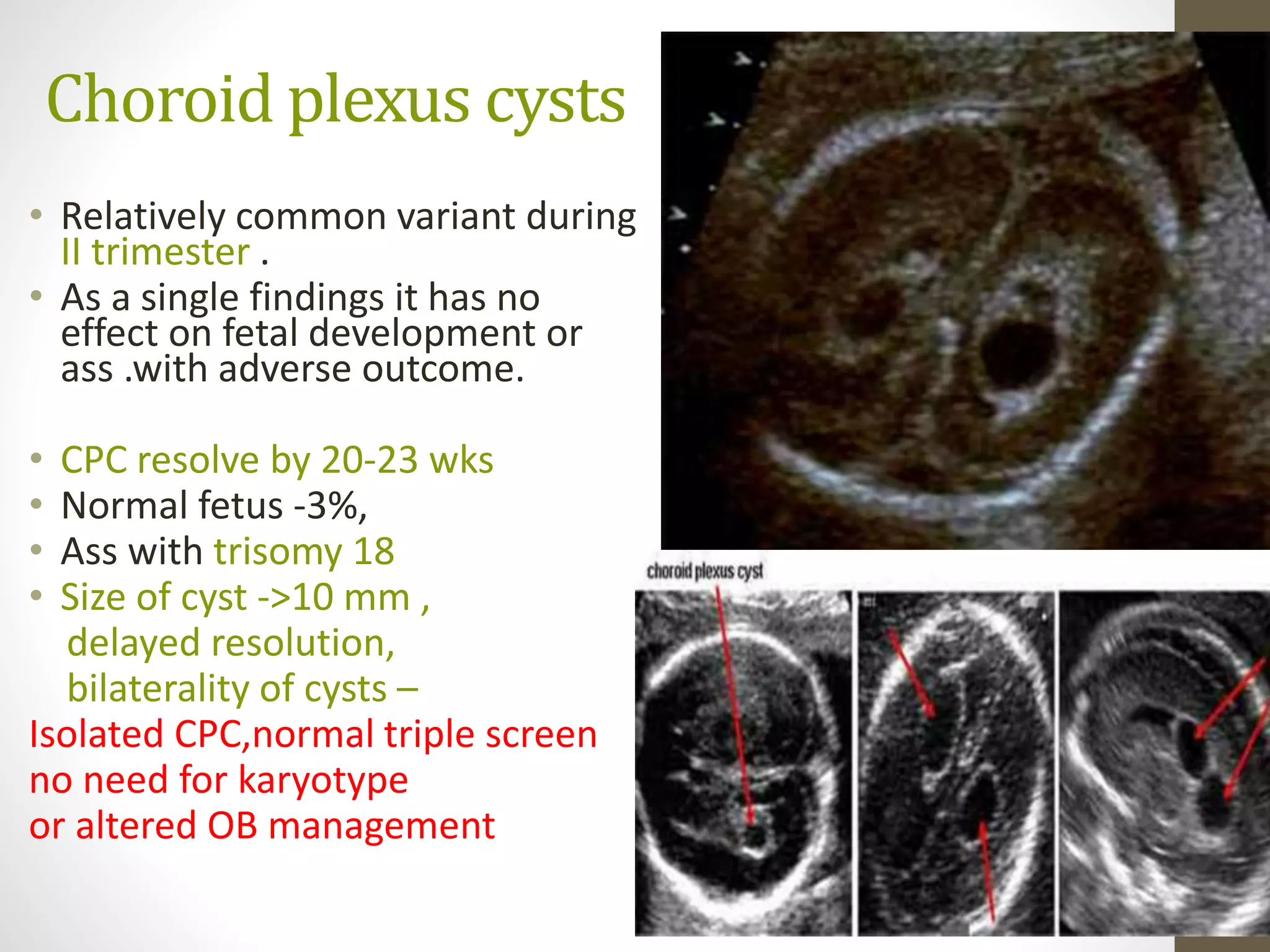 Target scan for fetal anomalies | PPTX