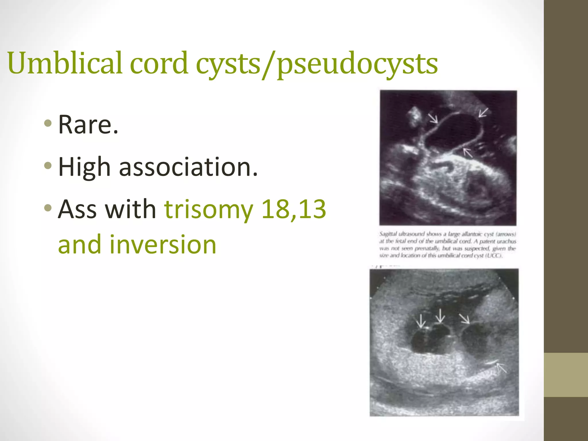 Target scan for fetal anomalies | PPTX