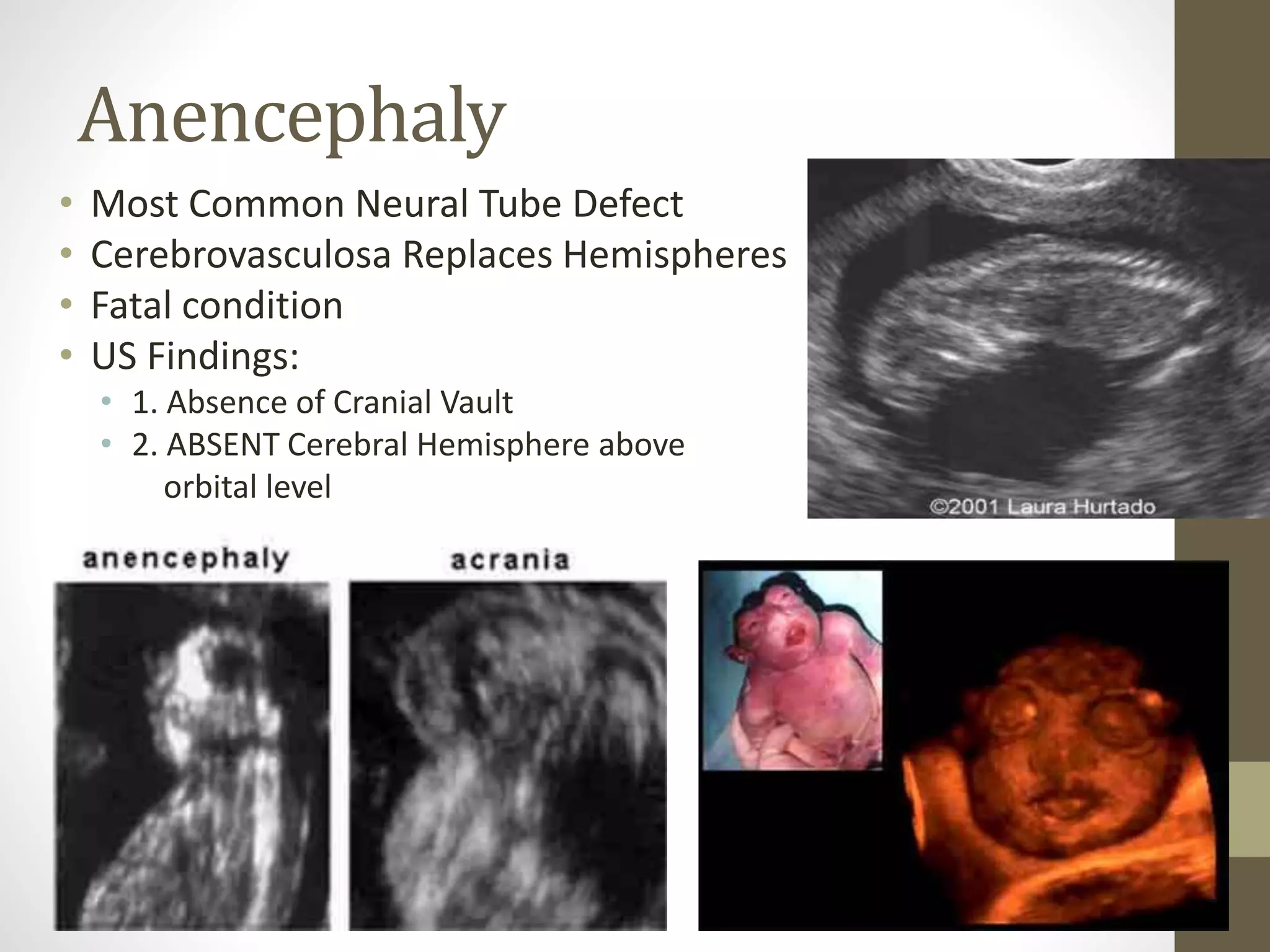 Target scan for fetal anomalies | PPTX