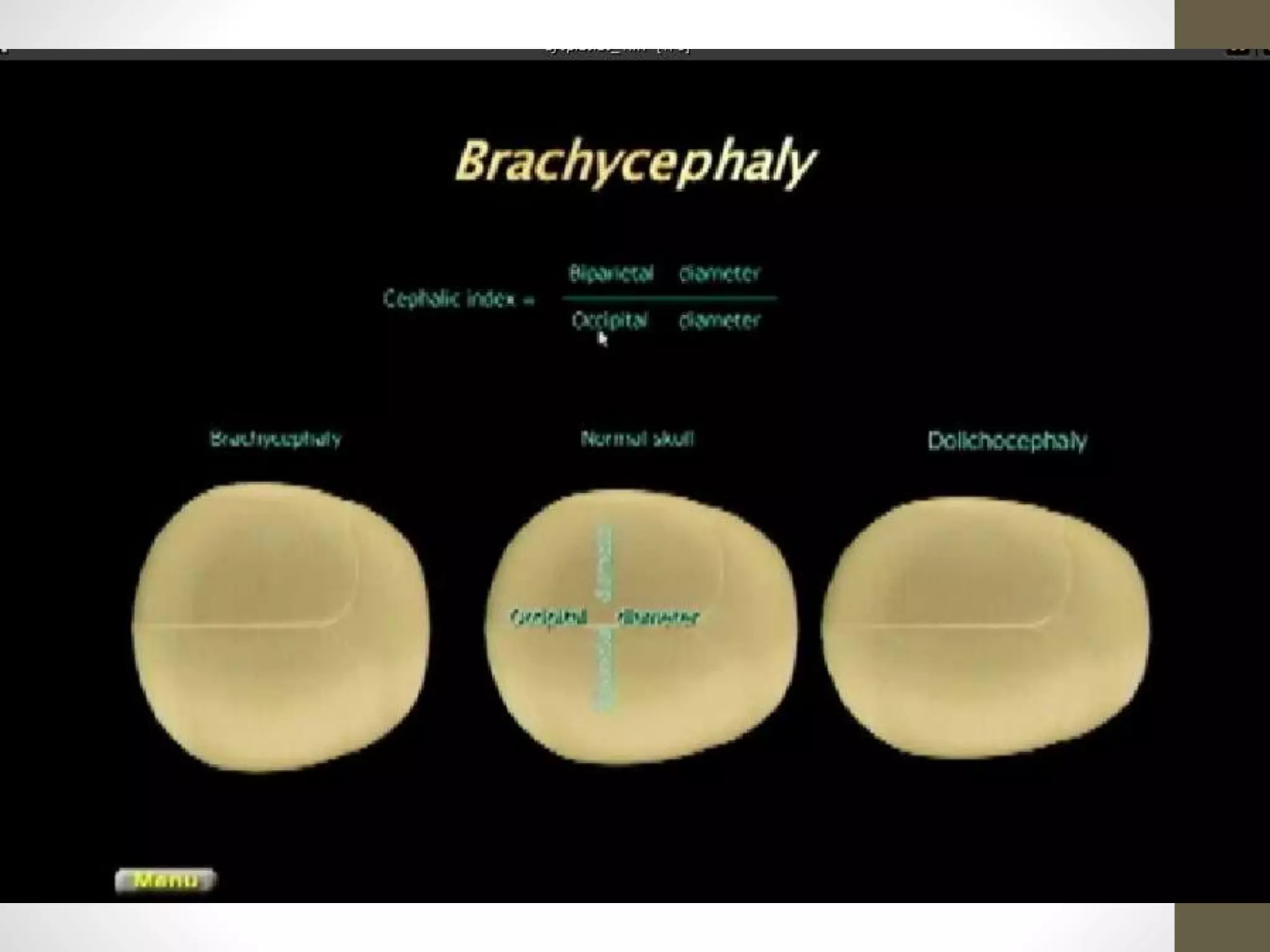 Target scan for fetal anomalies | PPTX