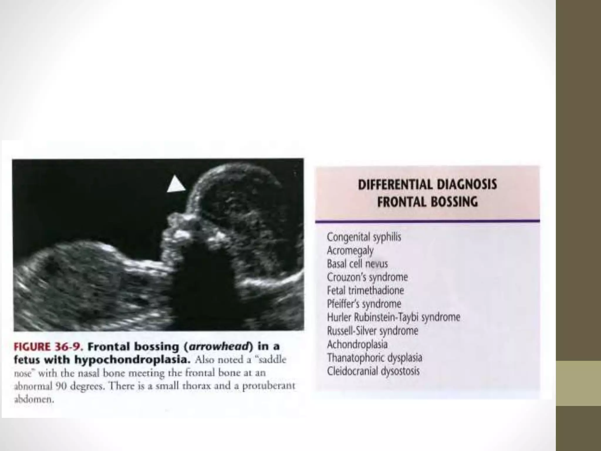 Target scan for fetal anomalies | PPTX