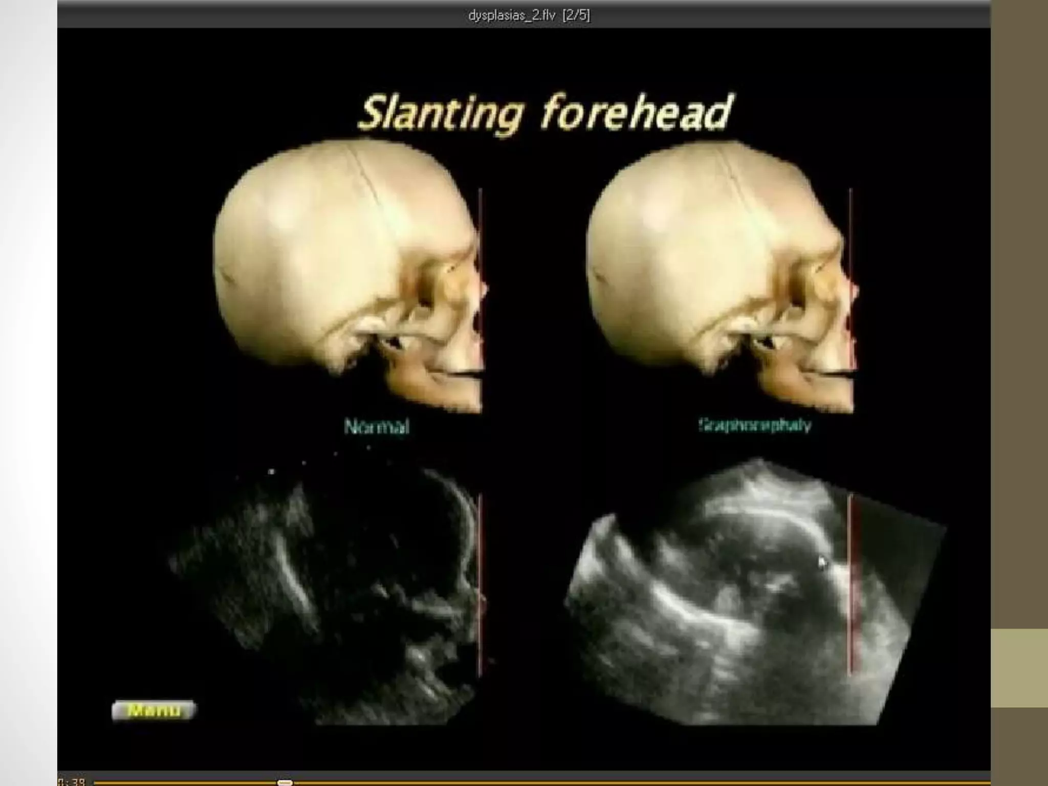 Target scan for fetal anomalies | PPTX