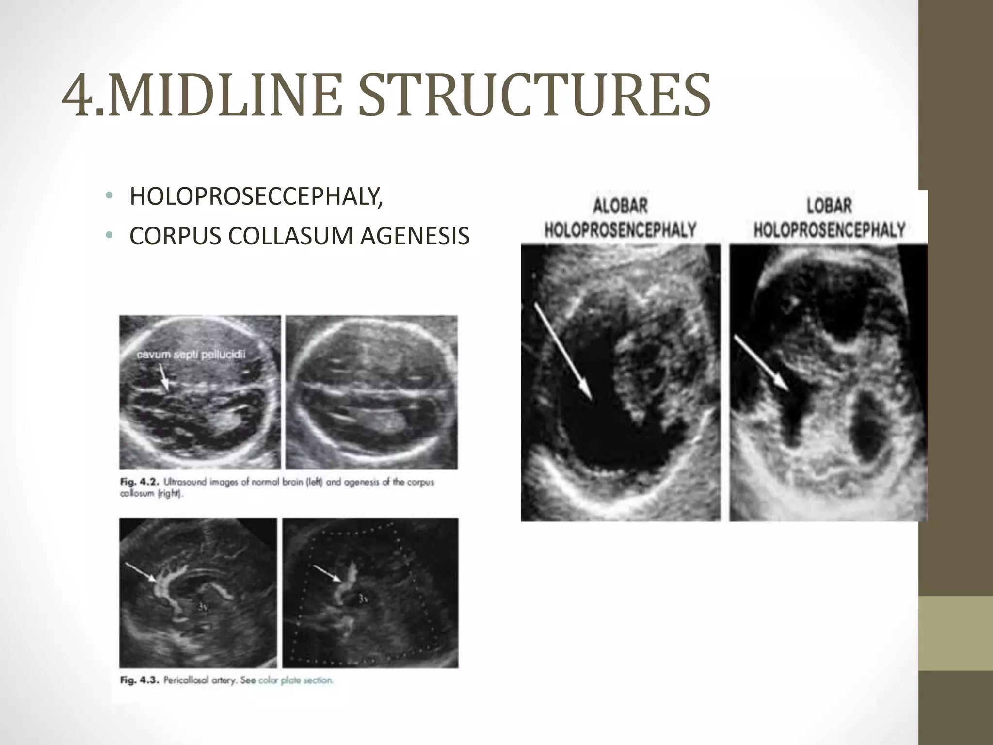 Target scan for fetal anomalies | PPTX