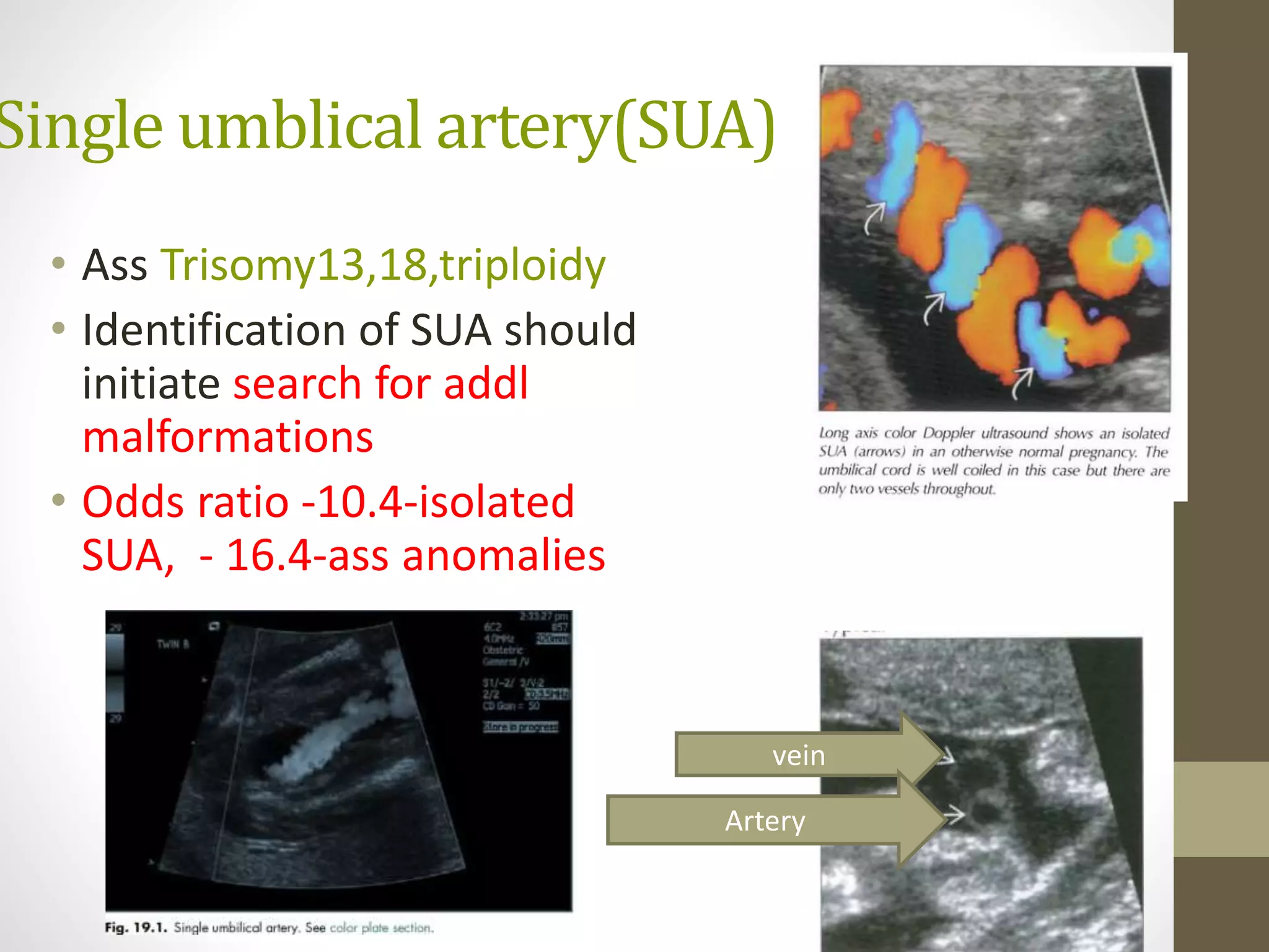 Target scan for fetal anomalies | PPTX