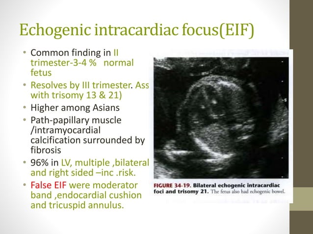 Target scan for fetal anomalies | PPT