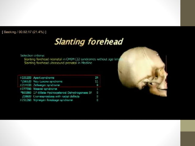 Target scan for fetal anomalies | PPT