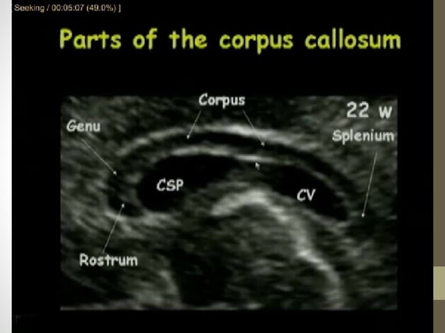 Target scan for fetal anomalies | PPT