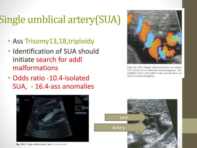 Target scan for fetal anomalies | PPT