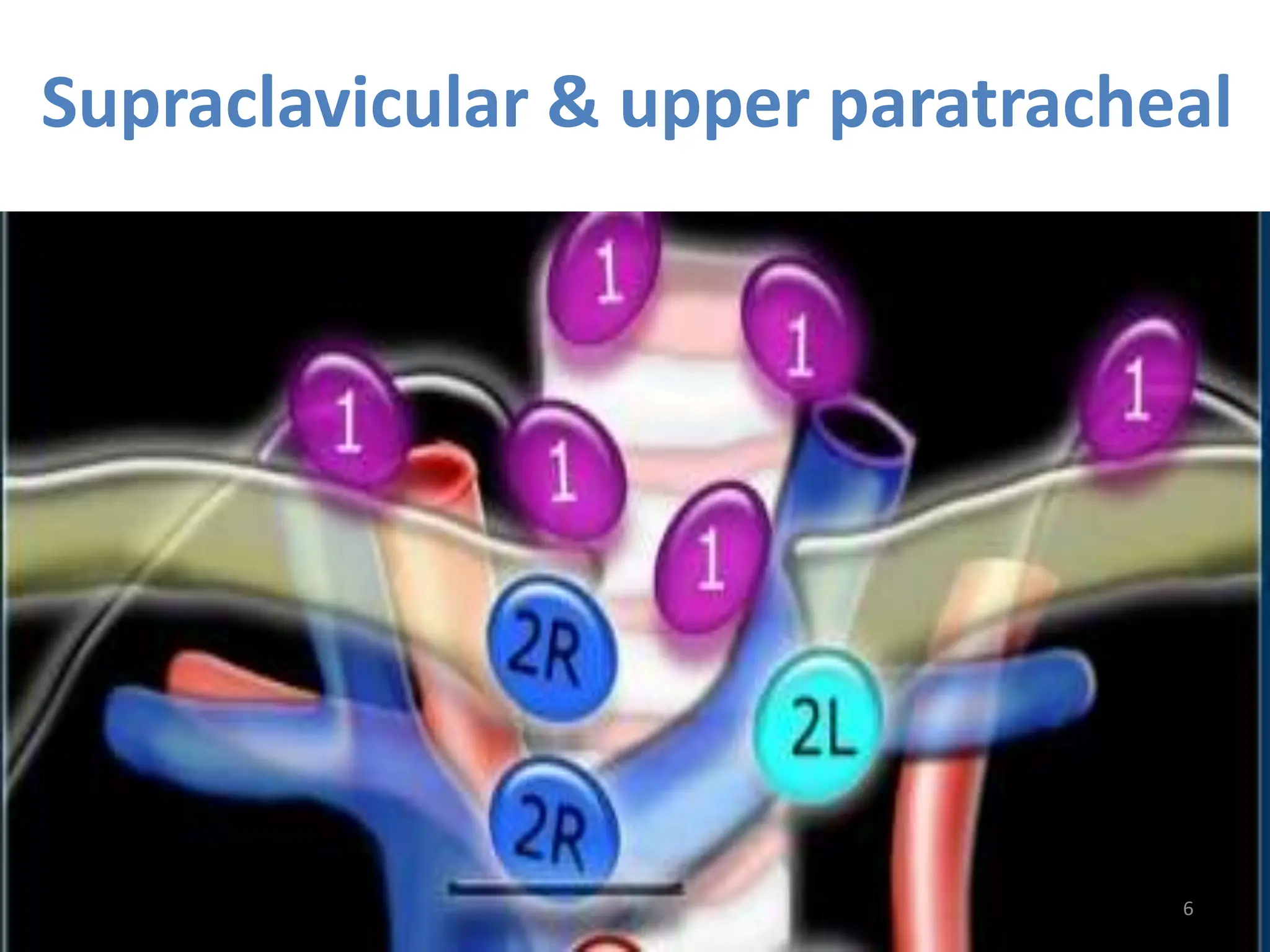 Target Delineation Of Thoracic Nodal Station Pptx