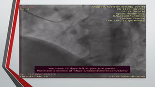 TARGET VESSEL PCI VS MULTIVESSEL PCI IN PAMI.pptx