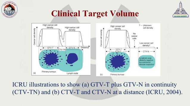 Target volume definition | PDF | Cancer | Diseases and Conditions