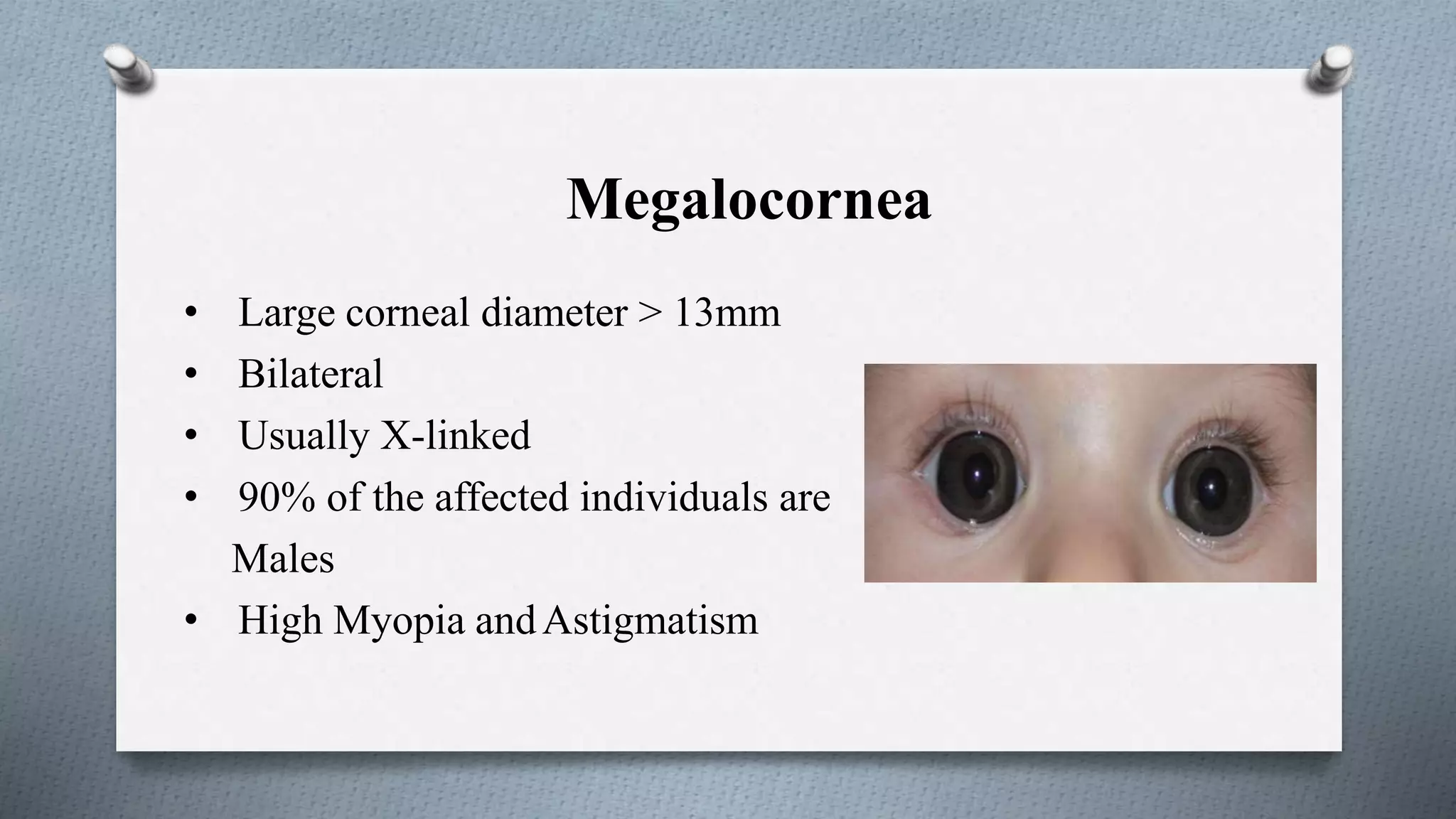 Corneal Diseases / abnormalities | PPTX