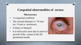 Corneal Diseases / abnormalities | PPTX