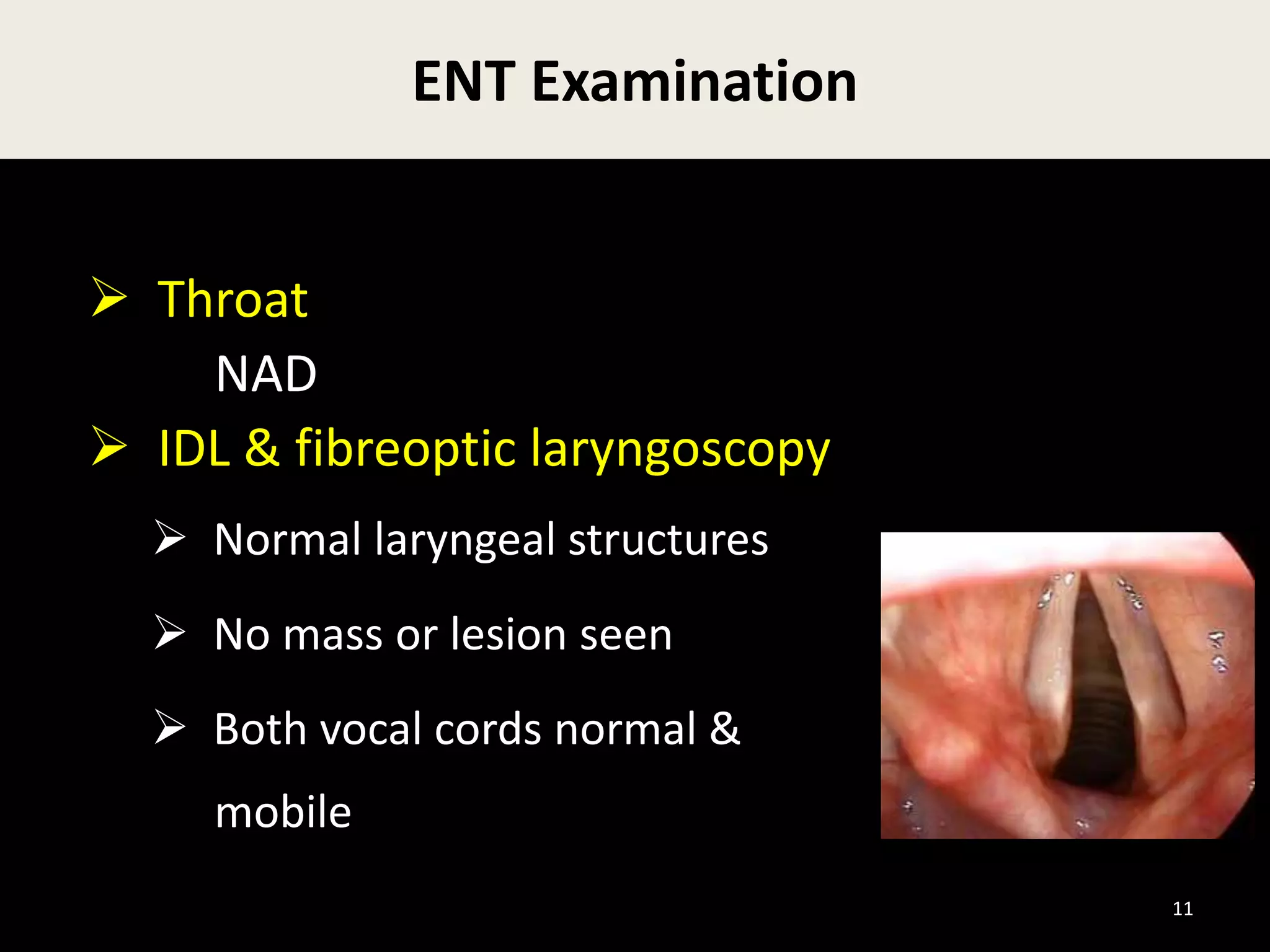 papillary thyroid carcinoma ppt | PPTX