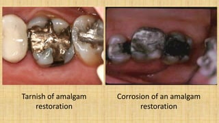 Tarnish and corrosion | PPTX | Dental Health | Diseases and Conditions