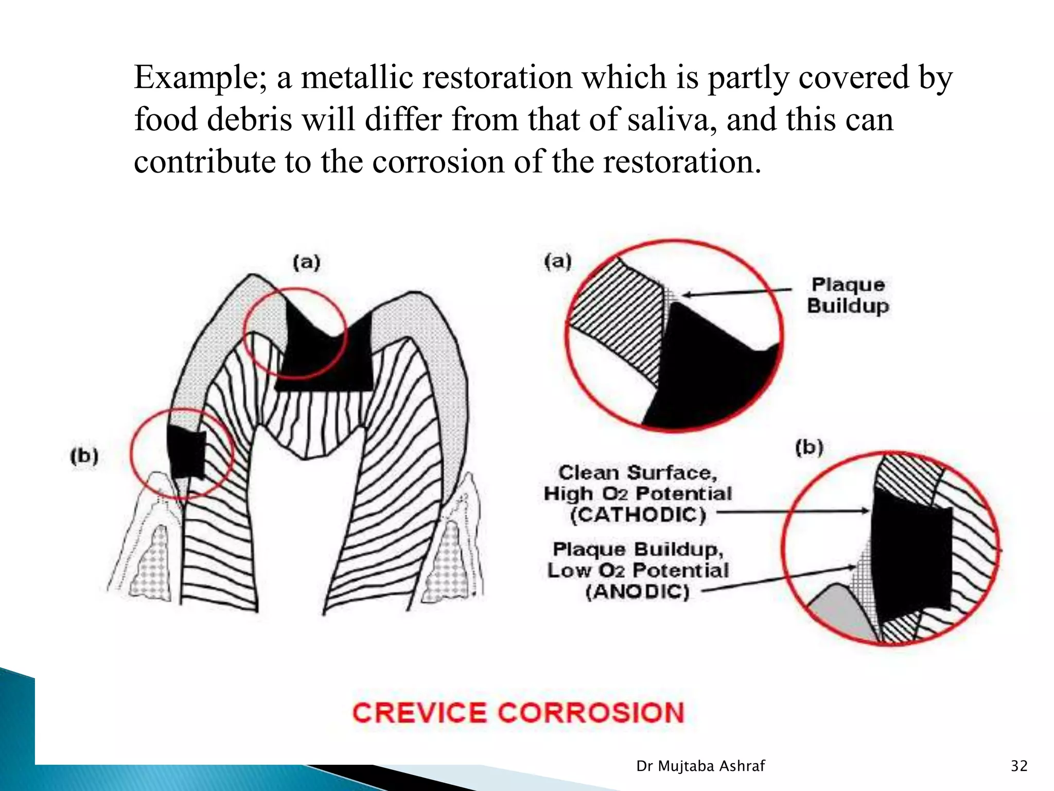 Tarnish & corrosion in dentistry | PPTX