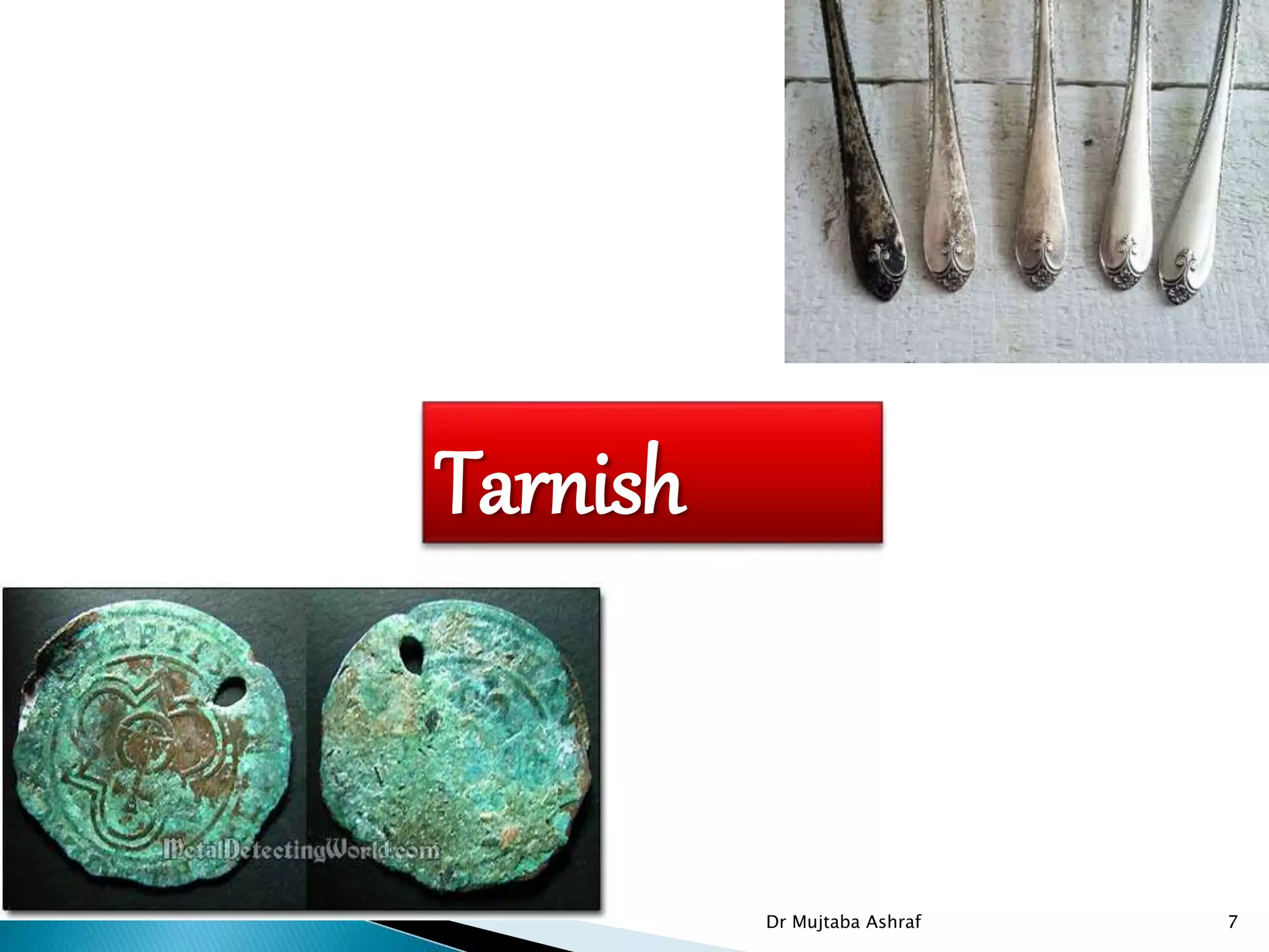 Tarnish & corrosion in dentistry | PPTX