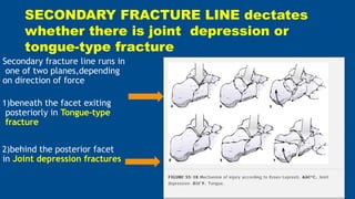Tarsal fracture.pptx Tarsal fracture Tarsal fracture | PPTX