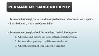 Tarsorrhaphy.pptx